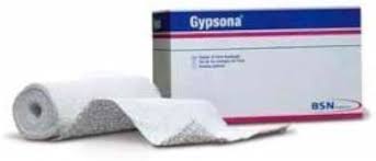 Gypsona S Extra Fast Setting Plaster of Paris, 6" x 5yds, 12/Box ...