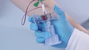 Steripath Blood Collection System w/Luer & Transfer Adapter, Sterile ...